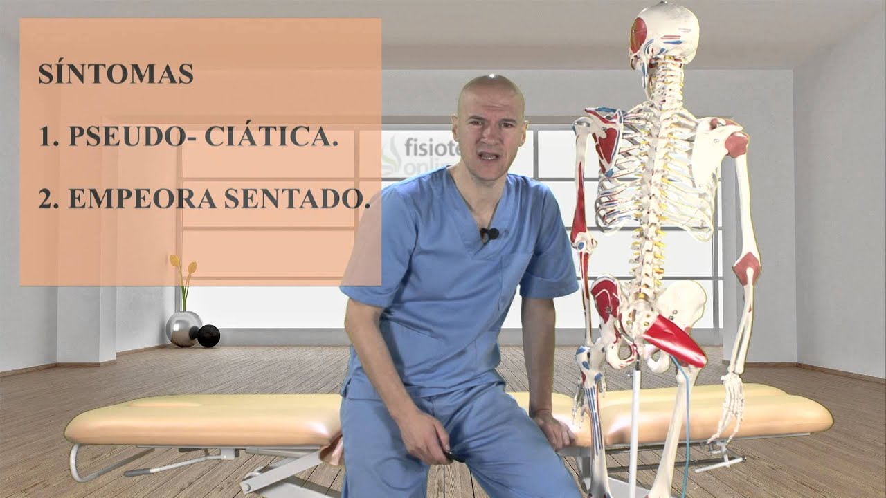 Qué es el síndrome del músculo piramidal y cuáles son sus síntomas y ...