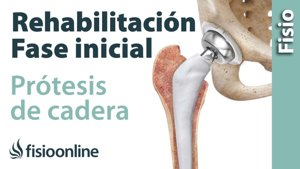 ֍ Cirugía de Protesis de cadera: Cómo se realiza la operación y cómo es ...