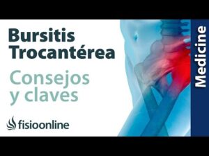 ֍ Me duele la cadera: Trocanteritis o bursitis trocantérea ⚕️ Clínica ...