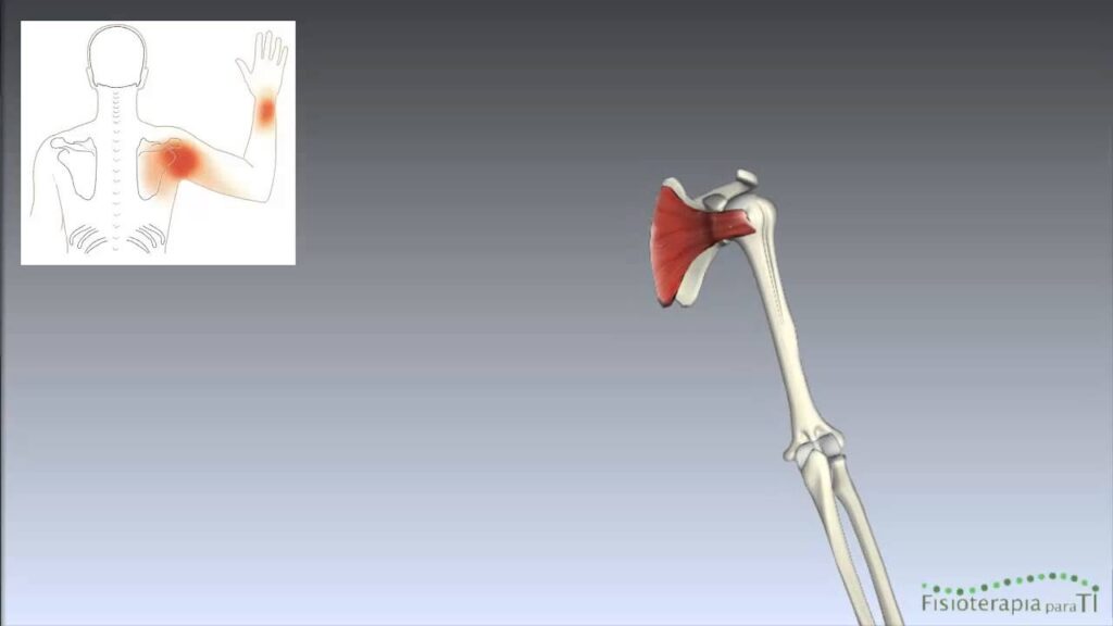 ֍ Músculo subescapular ⚕️ Clínica Estemedic