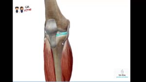 ֍ Lesión del Ligamento Colateral Medial: ¿Qué es? ⚕️ Clínica Estemedic