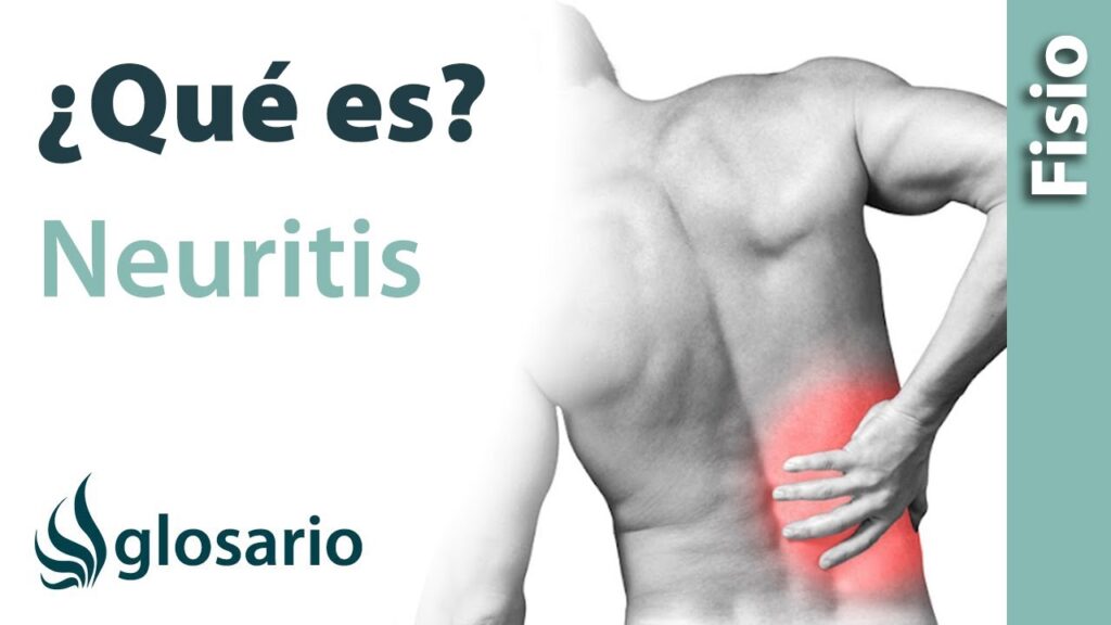 ֍ Neuritis ⚕️ Clínica Estemedic