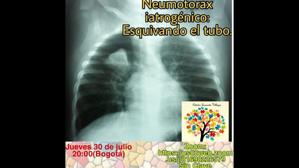 ֍ Neumotorax: manifestaciones y tratamiento ⚕️ Clínica Estemedic