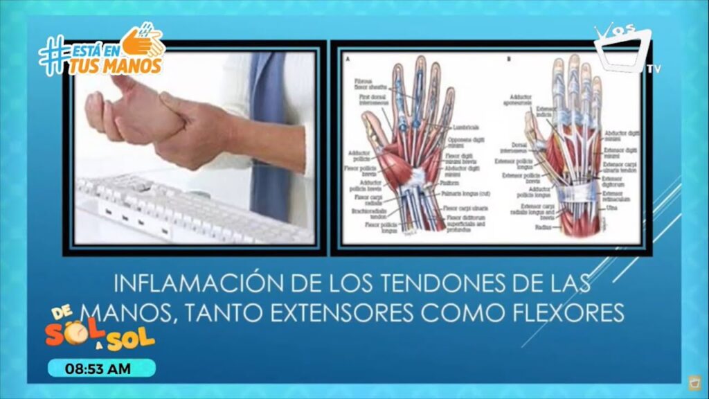 ֍ Qué es la tendinitis y cuáles son sus causas: síntomas y tratamiento ...