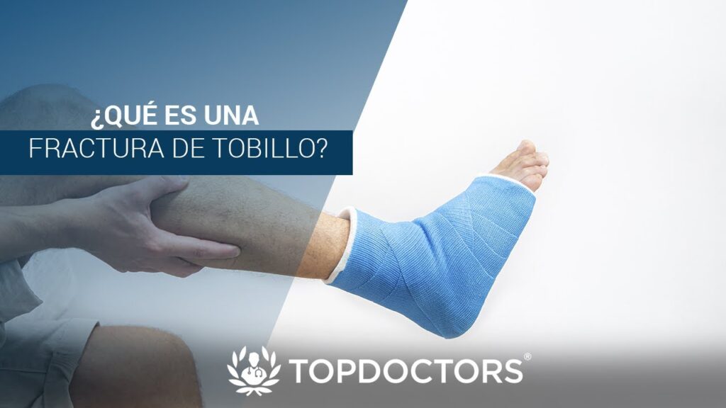 ֍ Fracturas de tobillo ⚕️ Clínica Estemedic