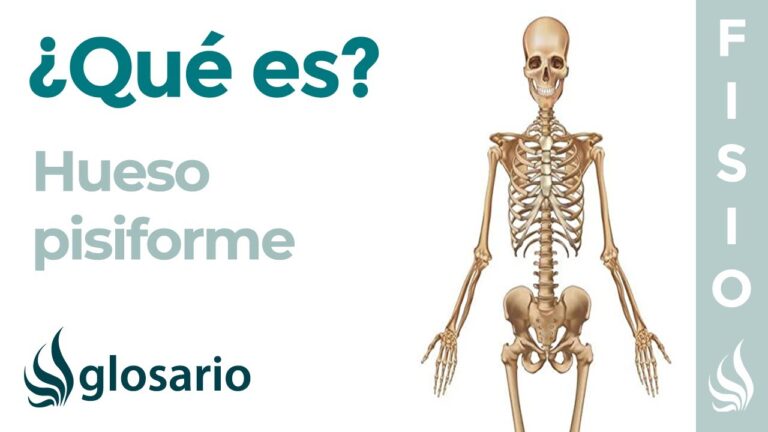 ֍ Hueso pisiforme ⚕️ Clínica Estemedic