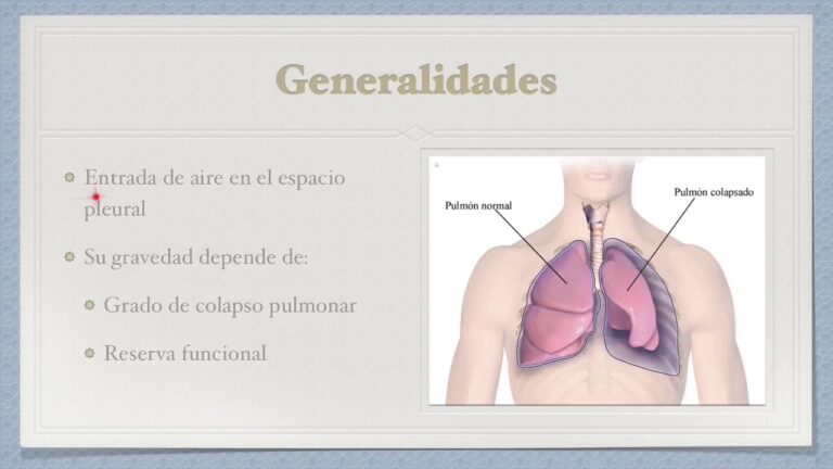 ֍ Neumotorax: clínica y clasificación ⚕️ Clínica Estemedic