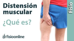 Qué es y causas y tratamiento de una distensión muscular o de ligamento ...
