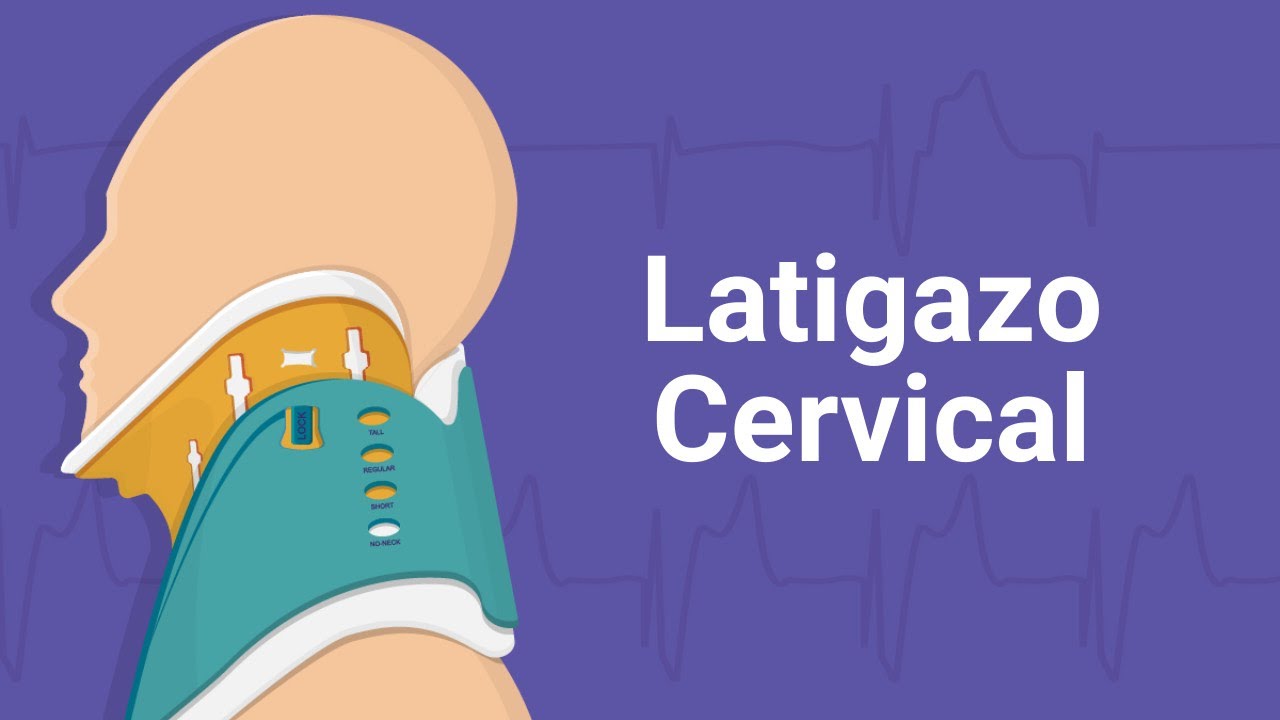 ֍ El latigazo cervical ⚕️ Clínica Estemedic